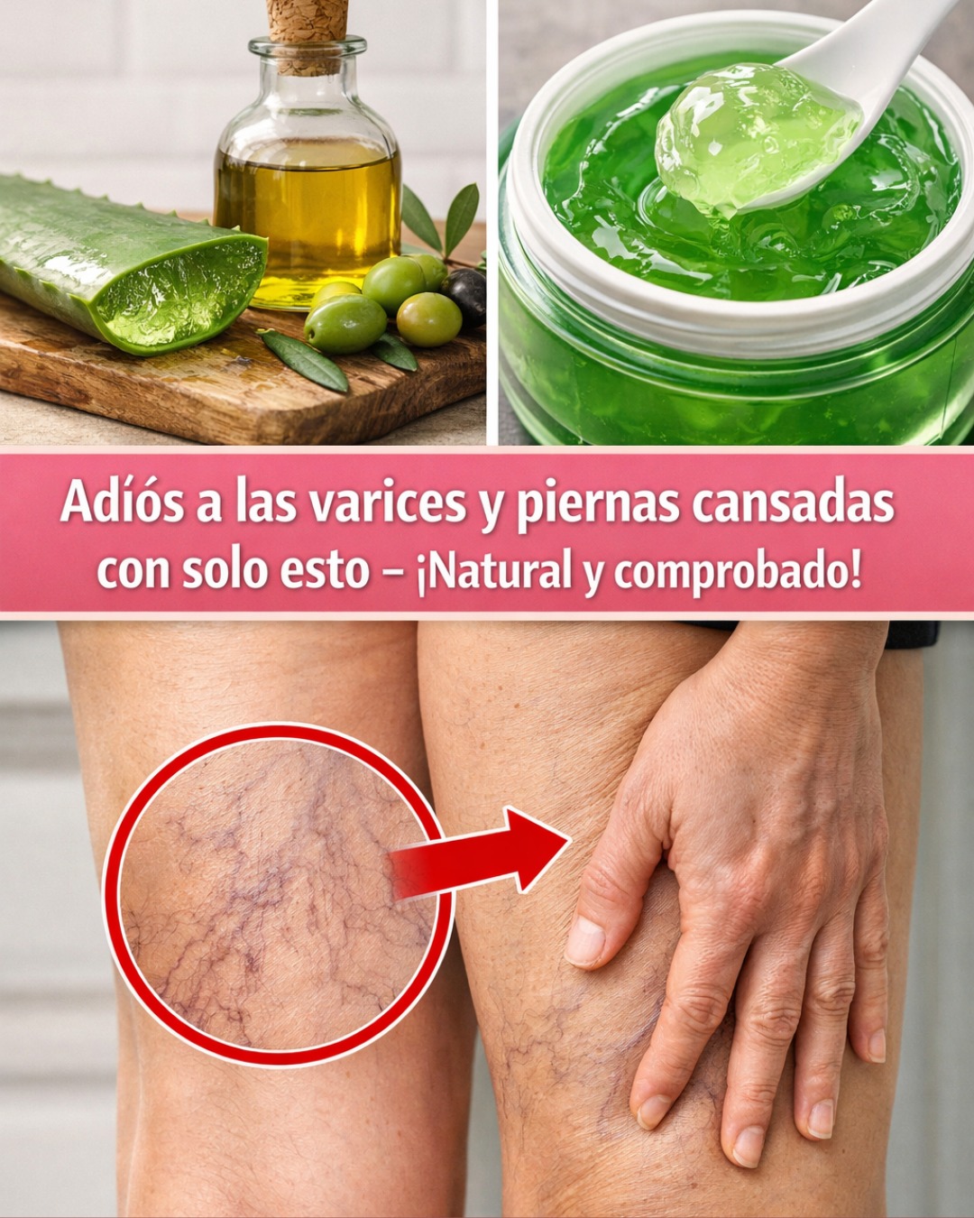 El remedio casero que mi abuela usaba para las várices (solo 3 ...